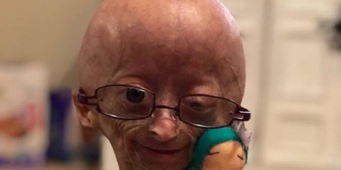 Adalia Rose - Trivia, Family, Bio | Famous Birthdays