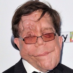 Adam Pearson Edad, Familia, Biografía | Famous Birthdays
